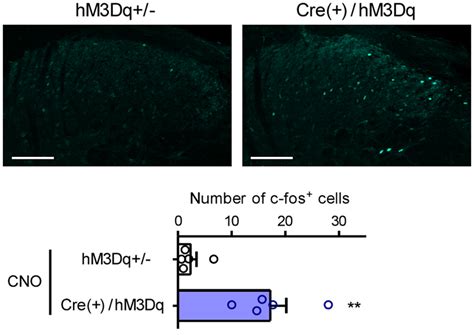 Expression Of C‐fos In The Spinal Dorsal Horn By Systemic Download Scientific Diagram