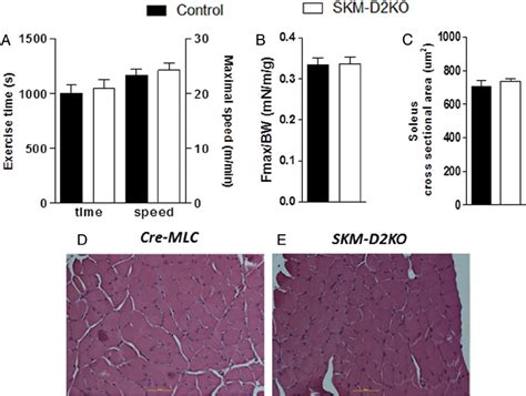 Treadmill Maximal Exercise Capacity Muscle Strength And Download Scientific Diagram