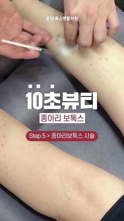 종아리알 쏙 빼줄 종아리보톡스 어떤가요 Youtube