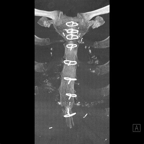 Viewing Playlist 111 Novpin Health Research Radiology Pathology