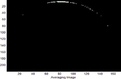 Figure 1 From Mri Image Segmentation Using Level Set Method And Implement An Medical Diagnosis
