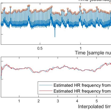 Top Estimated Spectrum Using SSWT Middle Segmented ECG Signal