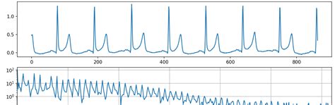 Time Series Ml Medium