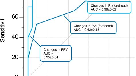 Testing Preload Responsiveness By The Tidal Volume Challenge Assessed By The