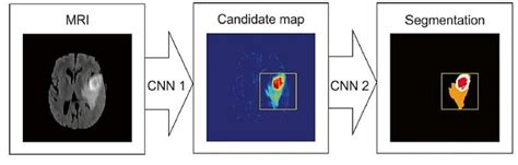 Schematic Illustration Of A Cascaded CNN Architecture For Brain Download Scientific Diagram