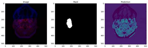 github dubidoo95 attention and transformer in u net