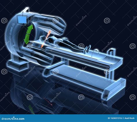 Thyroid Scan Scintigraphy Medically 3d Illustration Royalty Free