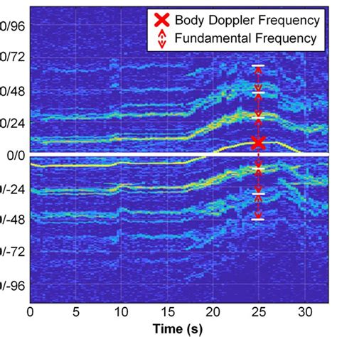 Doppler Spectrogram Db From Real Radar Measurements Of A Quadcopter Download Scientific