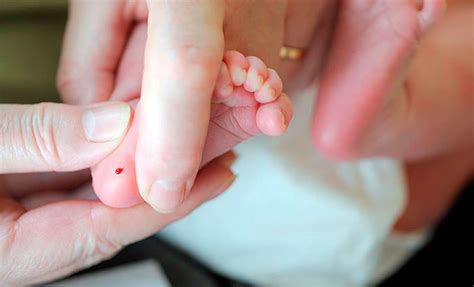 Issste Aplicará Prueba De Tamiz Neonatal Metabólico Ampliado En Recién