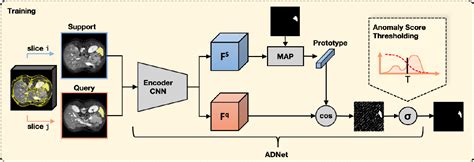 Figure 1 From Anomaly Detection Inspired Few Shot Medical Image