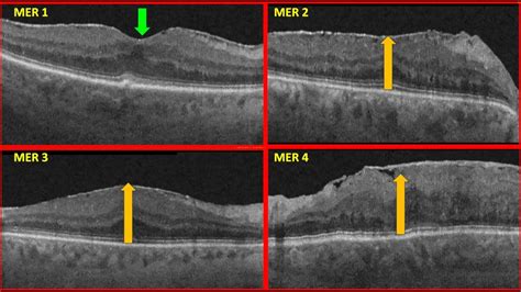 Clasificación De La Mer Youtube