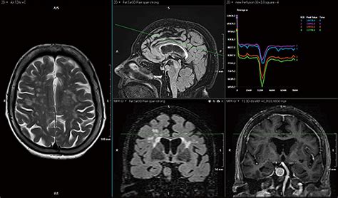 Multi Modality Modality Applications Healthcare It Products Canon Medical Systems Usa
