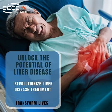 Secomind Ai On Linkedin Ai Healthcare Research Treatment