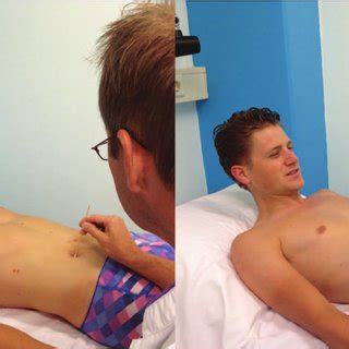 The Trigger Point Is Localized And Palpated Using A Finger Or A Swab Download Scientific