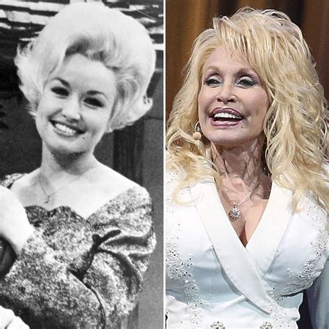 Dolly Parton Plastic Surgery Dolly Partons Journey With Plastic