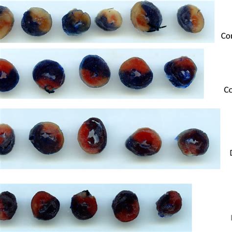 Tetrazolium Stained Slices From Non Preconditioned Npc And