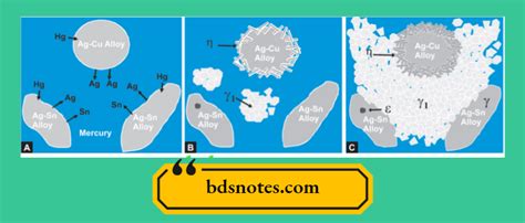 Dental Amalgam Alloys Low Copper Vs High Copper Explained Bds Notes