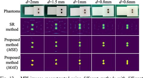 Figure 12 From Image Reconstruction For Magnetic Particle Imaging Based On Sparse Representation