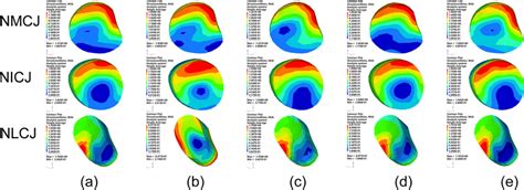 The Von Mises Stress Of Nmcj Nicj And Nlcj Cartilage In Each Operating Download Scientific