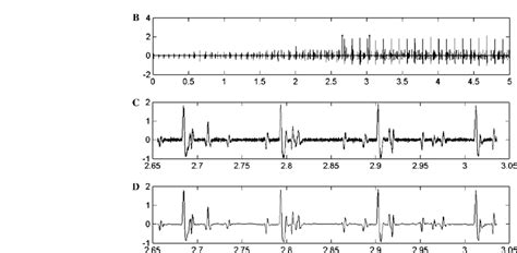An Example Of Denoising Process Based On The Wavelet Filtering And
