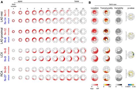 Representative Infarct Patterns Depending On Treatment Immediate Vs Download Scientific