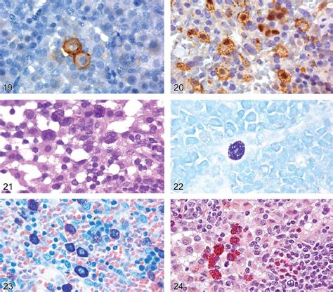 —lymph Node From An Adult B6129 Mouse With Sinusoidal Mast Cells Download Scientific Diagram