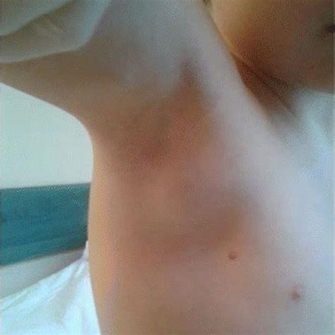 What Does A Cat Lymph Node Feel Like Diy Seattle