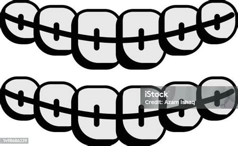 교정기 또는 치아 교정기 개념 교정 케이스 벡터 아이콘 디자인 틀니 기호 구강 건강 관리 기호 치과 기구 스톡 일러스트레이션 개선에 대한 스톡 벡터 아트 및 기타 이미지