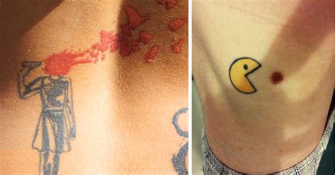 10 People Turned Their Birthmarks Into Tattoos Demilked