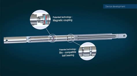 Medical Device Development Mps Microsystems Youtube