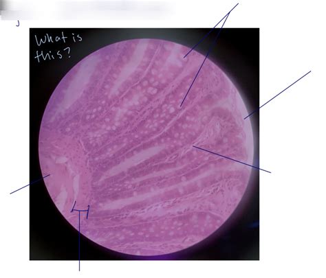 Histology Of Large Intestine Diagram Quizlet