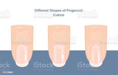 손톱 큐피클의 다른 모양 매니큐어 가이드 벡터 일러스트레이션 손톱에 대한 스톡 벡터 아트 및 기타 이미지 손톱 다양 큐티클 Istock