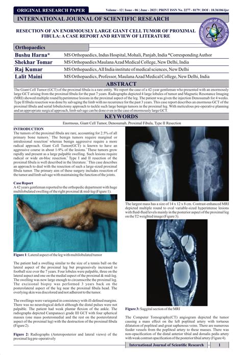 Pdf Original Research Paper Resection Of An Enormously Large Giant Cell Tumor Of Proximal