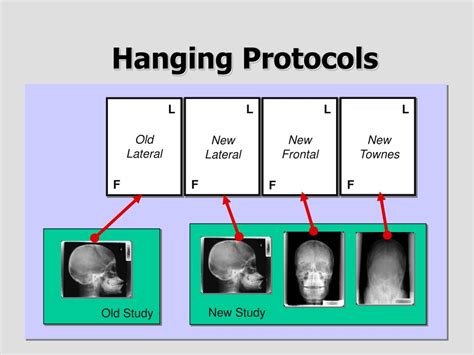 Ppt Dicom Display Update Color Presentation States Hanging Protocols Powerpoint Presentation