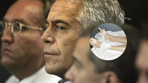 Autopsia De Jeffrey Epstein Demostraría Que No Fue Un Suicidio Fotos