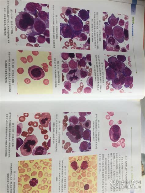 血细胞形态学诊断图谱 原始红细胞 伤感说说吧