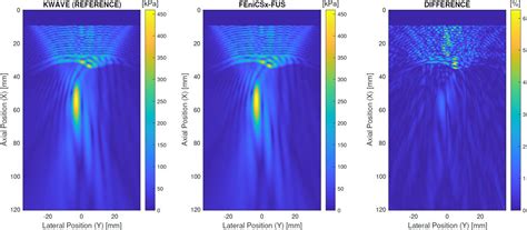 A Fast Finite Element Solver For Focused Ultrasound Applications Siam