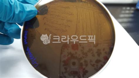 미생물 실험 배지 실험결과 배양 사진이미지일러스트캘리그라피 Nskawl1101작가