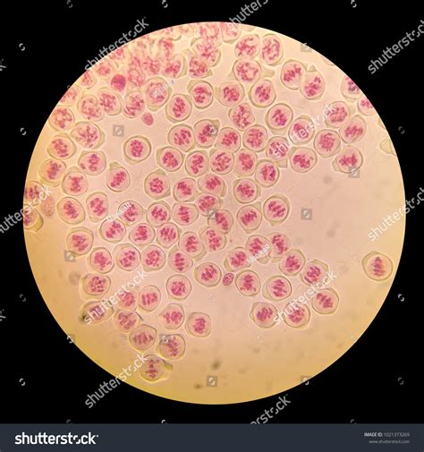 Meiosis Under Microscope