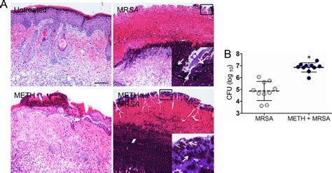 Meth Enhances Mrsa Burden In Superficial Skin Lesions A Histological Download Scientific