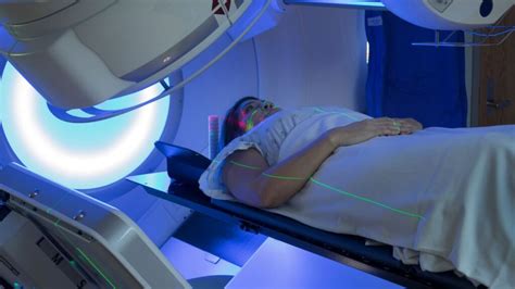 Radiotherapy For Lung Cancer Roy Castle