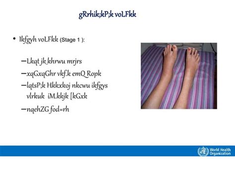 Filaria Stages In Marathi Ppt