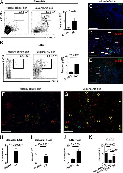 Figure 1 From This Information Is Current As Responses In Inflamed Skin Basophils Promote Innate