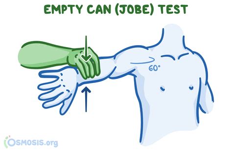 Empty Can Test Shoulder Rotator Cuff Impingement Spec