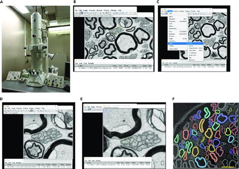 Transmission Electron Microscope Engineering Physics At Imogen Parry