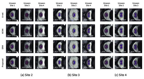 Segmentation Results On The Spinal Cord Segmentation Task Obtained From Download Scientific