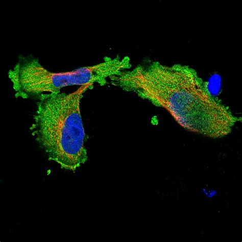 Subcellular Egfr The Human Protein Atlas