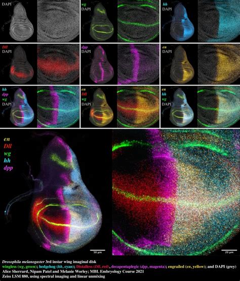 Microscopymonday Nipam Patel