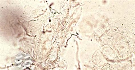 Microscopy Of Microsporum Canis Image