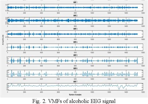 Figure 2 From Alcoholism Identification From Variational Mode Decomposed Eeg Signal Using